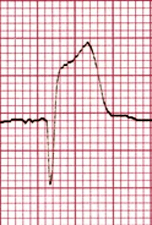 ST Segmenti - Acilci.Net