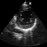 Temel Ultrasonografi – Kardiyak Ultrasonografi - Acilci.Net