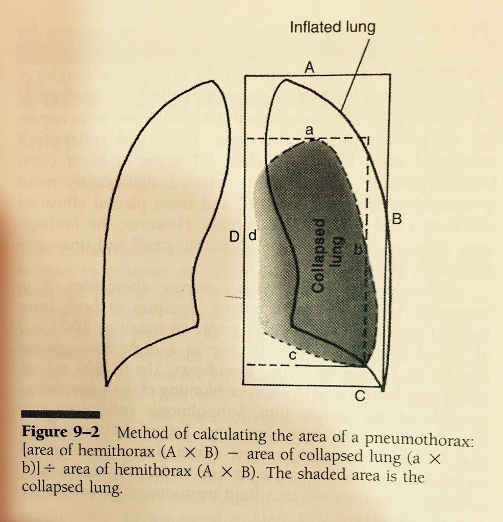 Toraks Projesi 1: Pnömotoraks - Acilci.Net