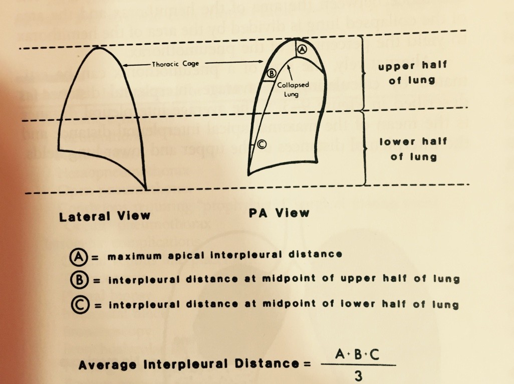 Toraks Projesi 1: Pnömotoraks - Acilci.Net
