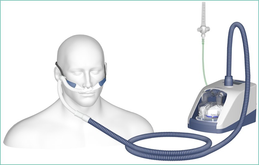 HFNO vs NIMV: Hangisi daha etkin? - Acilci.Net