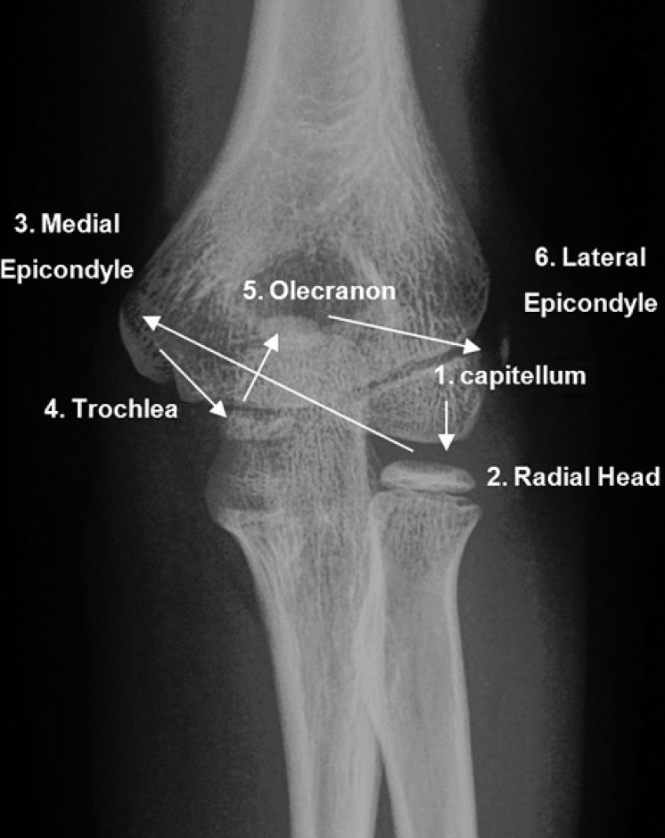 Pediatrik Hastalarda Dirsek Grafisi Değerlendirme - Acilci.Net
